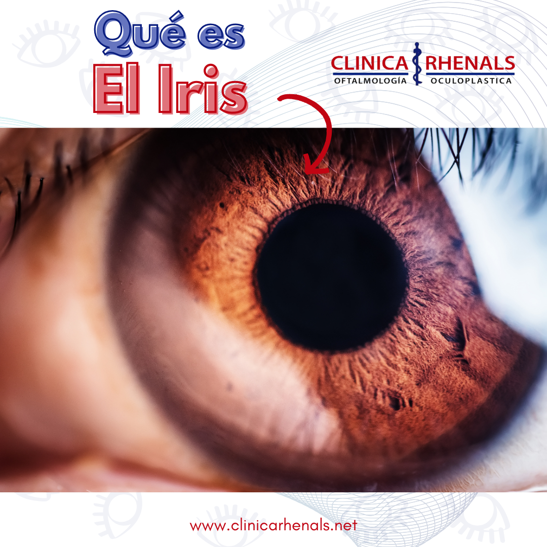 ClÃ­nica Rhenals | QuÃ© es el Iris?